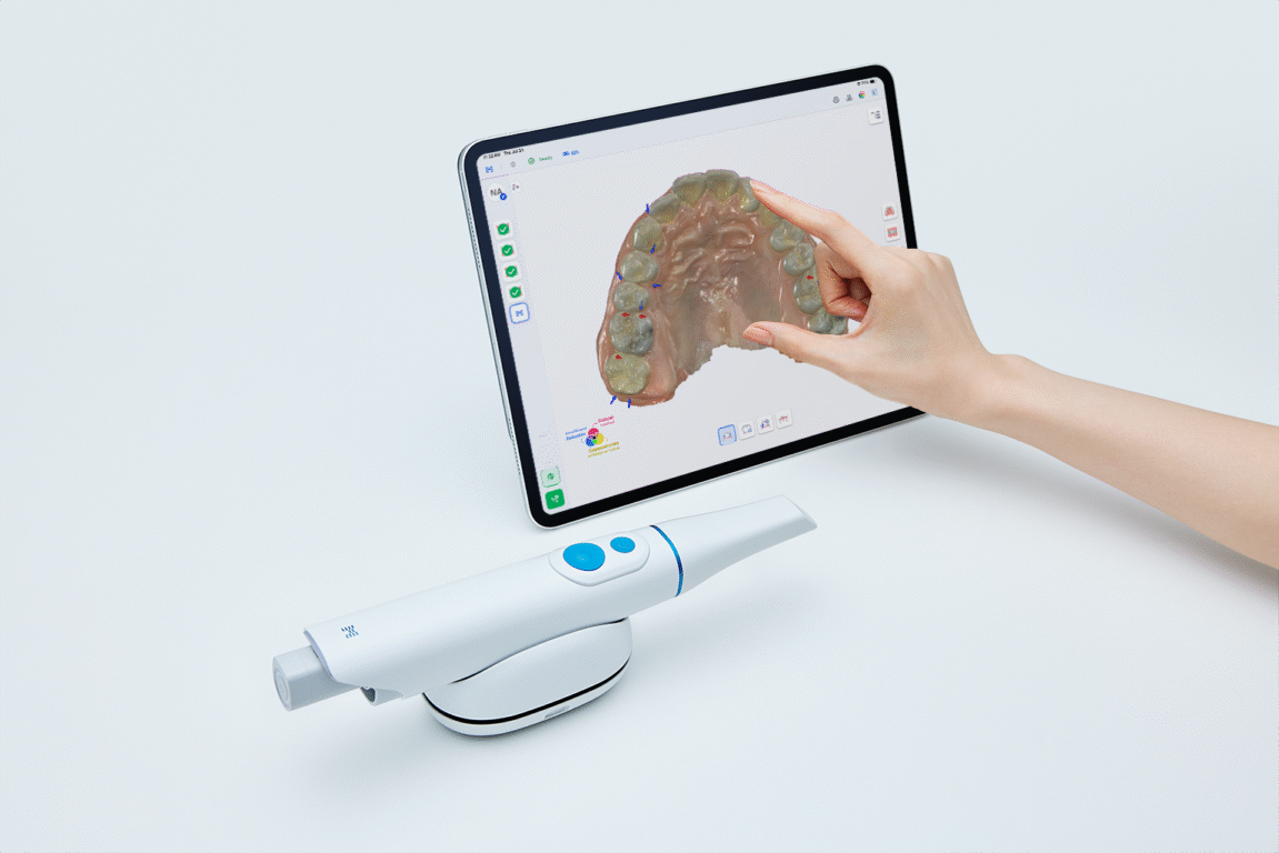 Scanner Intraoral MEDIT i900 Medit | Smart Dent - Especialista em ...